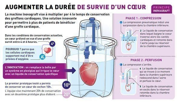 Greffe du cœur : des greffons qui tiennent la distance | Fondation pour ...