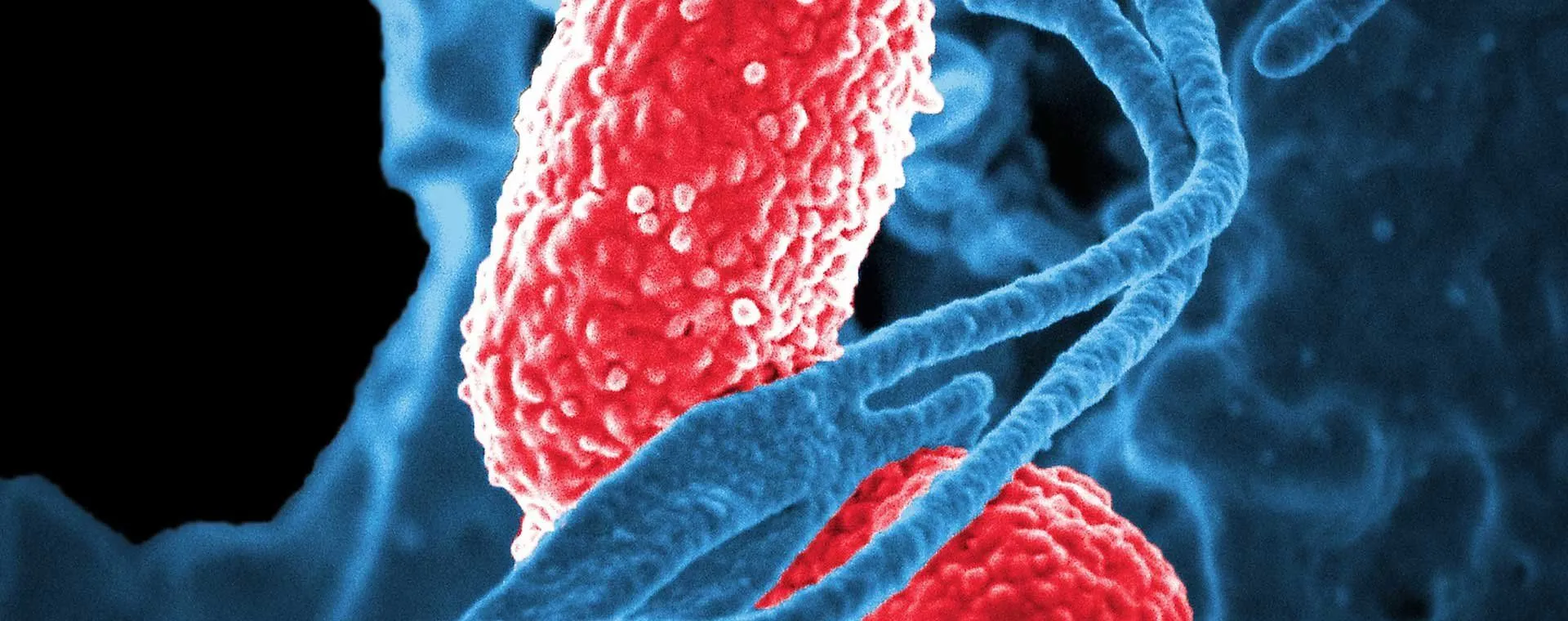 Tuberculose : Agir sur le système immunitaire pour lutter contre l ...